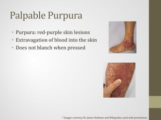 ImmunoSlides-393-424.pdf