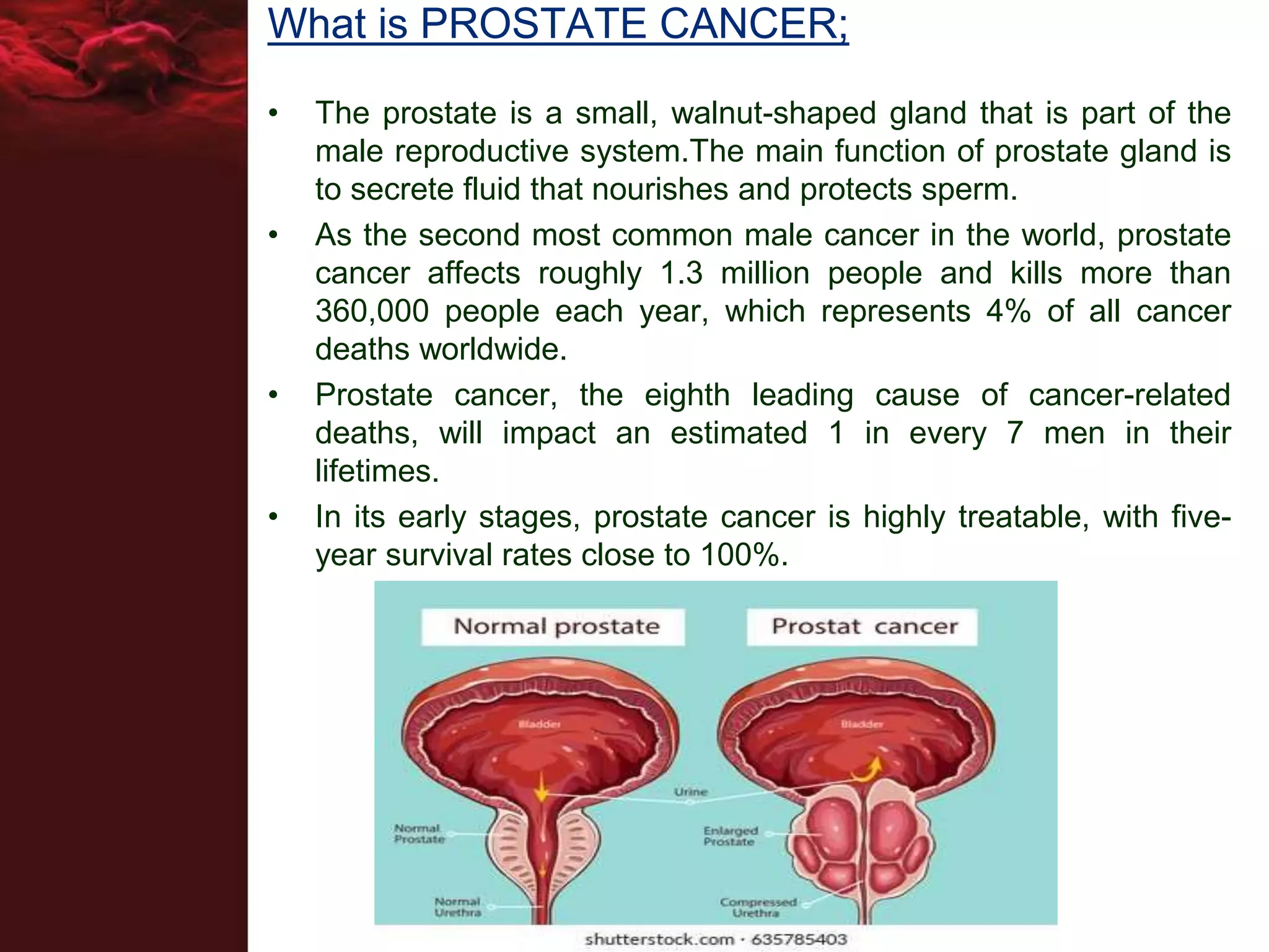 Immunotherapy in treating prostate cancer | PPT