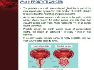 Immunotherapy in treating prostate cancer | PPTX