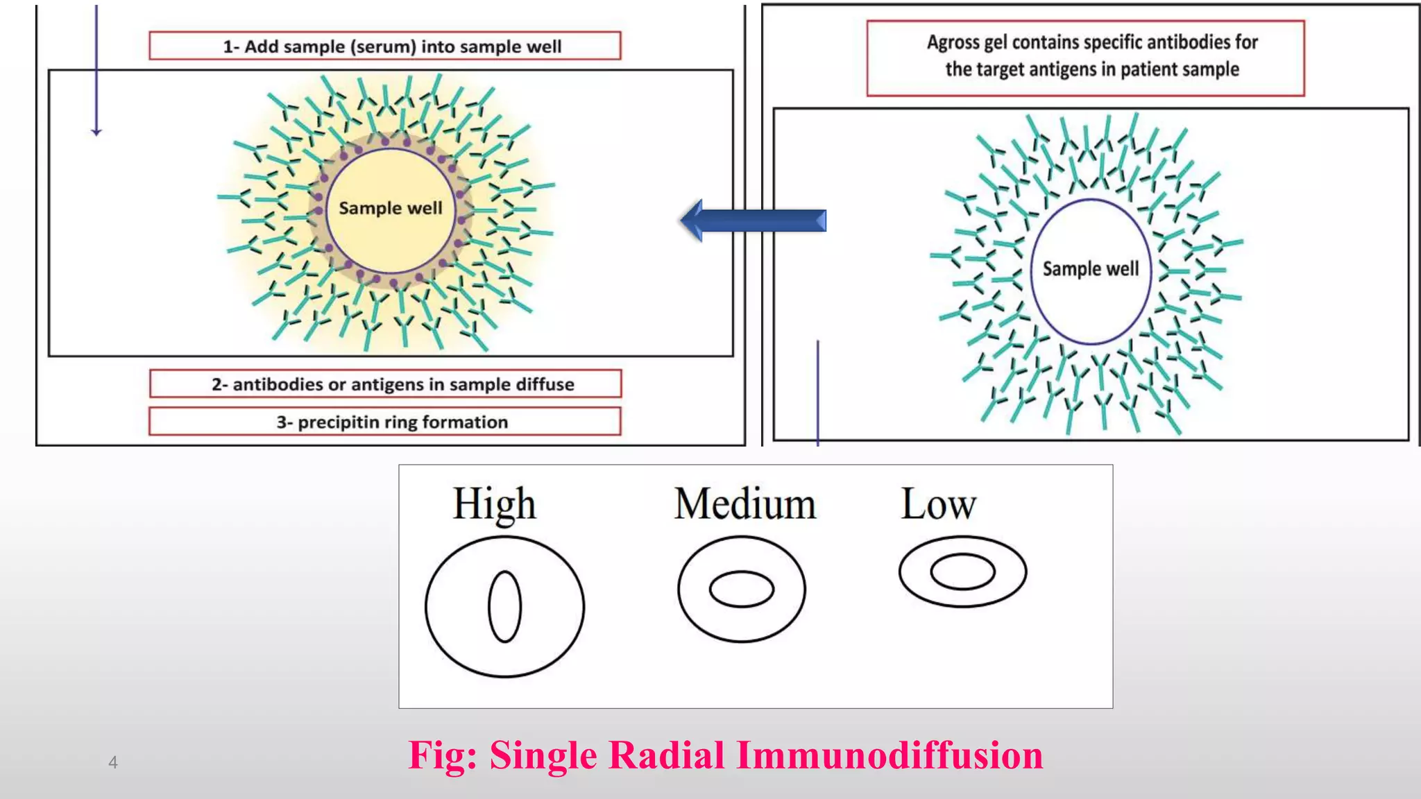 Single Radial Immunodiffusion | PPTX
