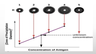 Single Radial Immunodiffusion | PPTX