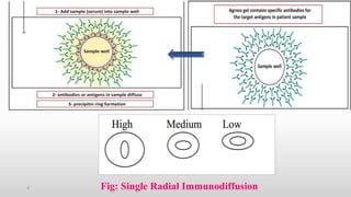 Single Radial Immunodiffusion | PPTX