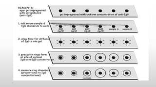 Single Radial Immunodiffusion | PPTX