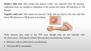Cell-mediated immunity (CMI) | PPTX | Skin and Dermatology | Diseases ...