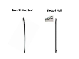 Im nail | PPT