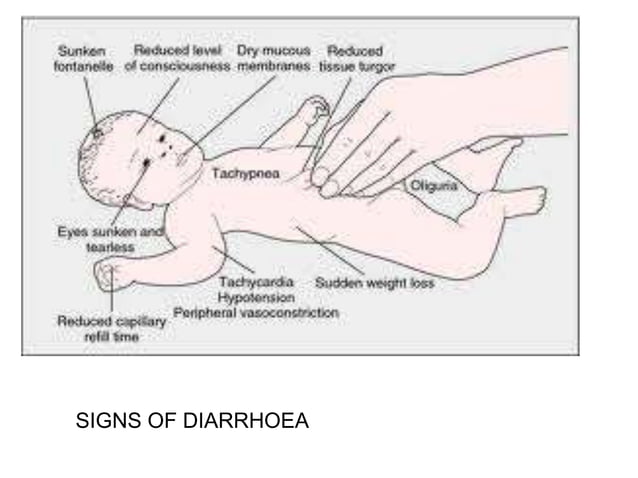 Integrated management of Neonatal and Childhood illness among Infants ...