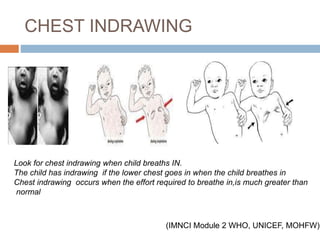 Integrated management of Neonatal and Childhood illness among Infants ...
