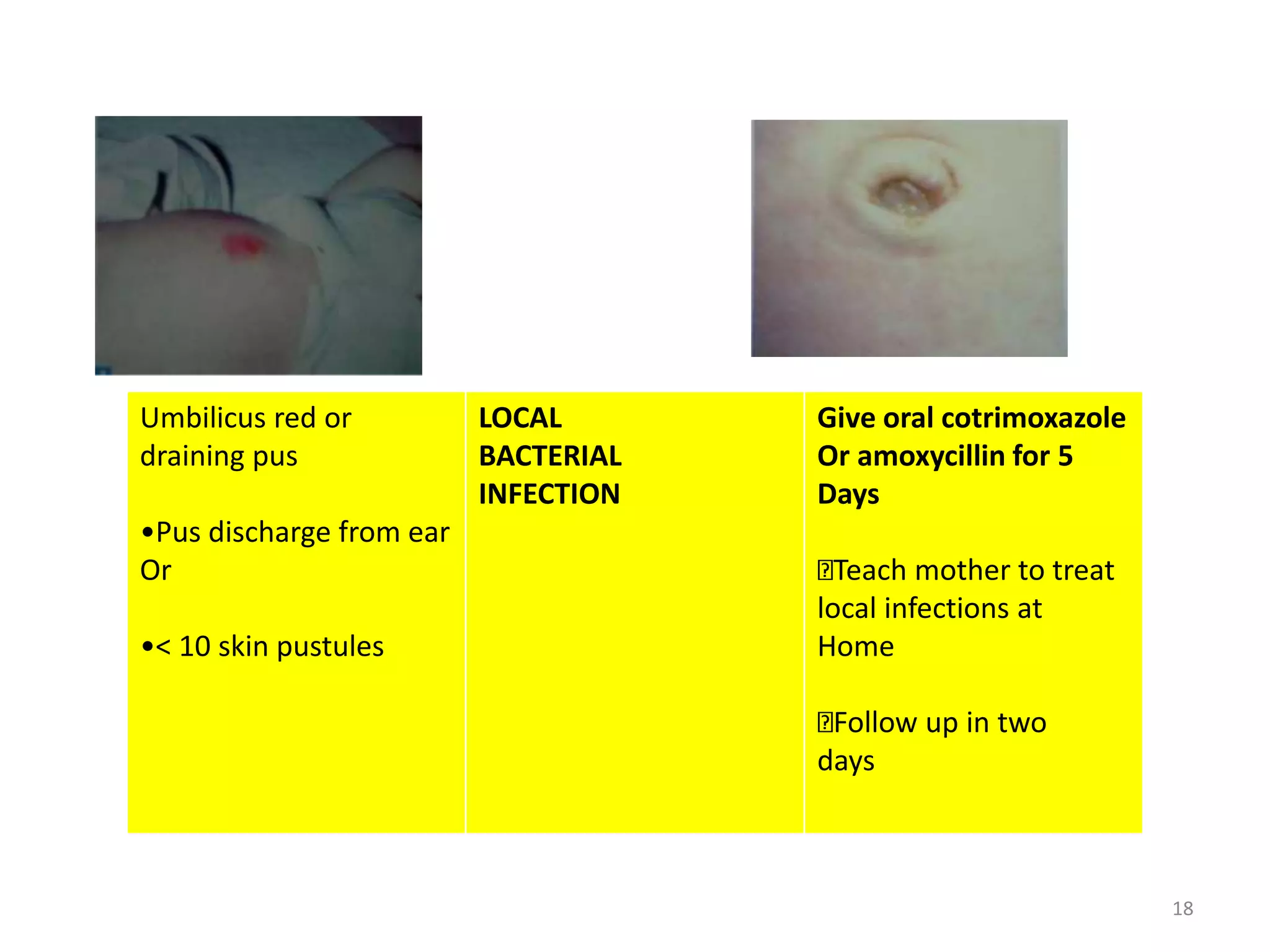 Integrated Management of Neonatal and Childhood Illness | PPTX