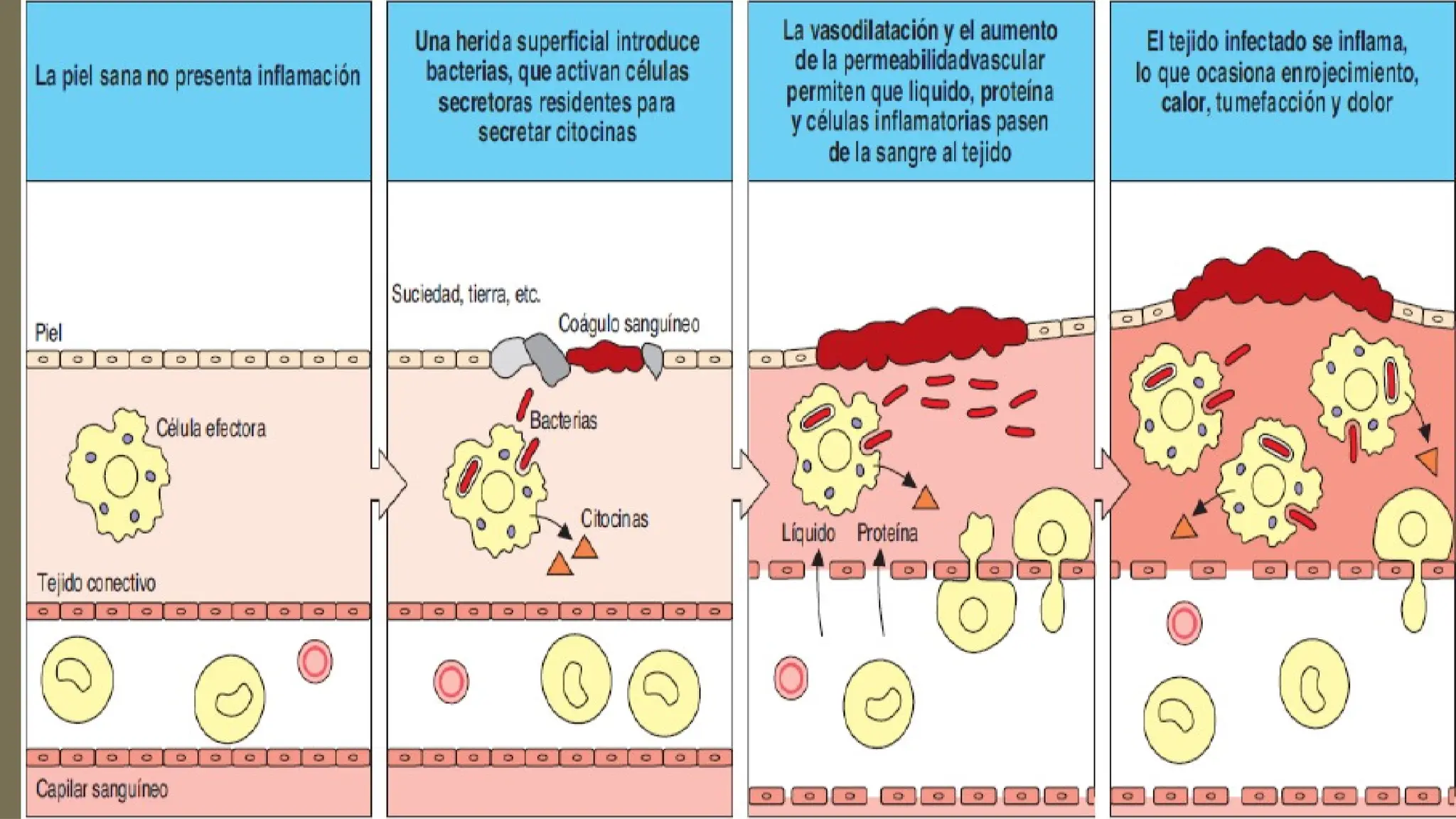 imnunologia inflamacion, fases de la inflamacion y respuesta ...