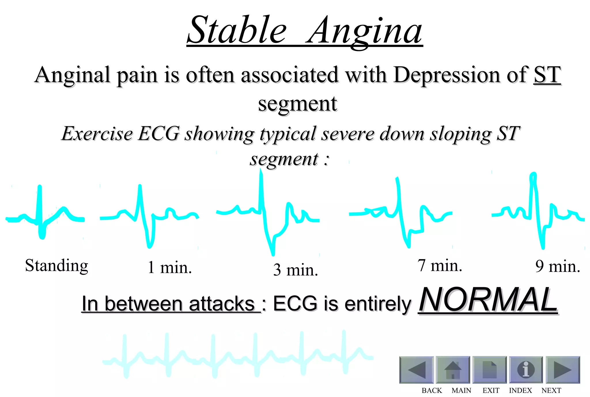 Management of Angina Pectoris | PPT