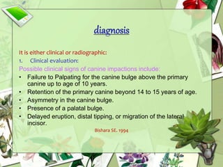 Impacted canine | PPT