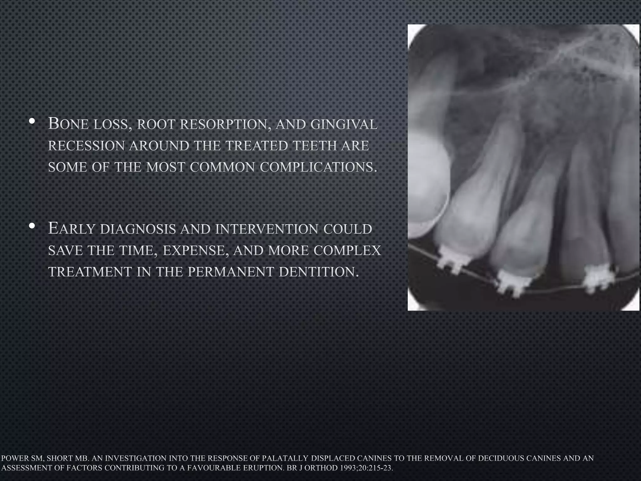 IMPACTED CANINE | PPTX