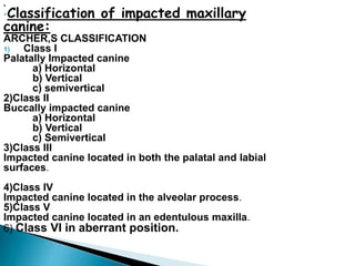 Impacted canine by dr.athar khan nishtar multan. | PPT