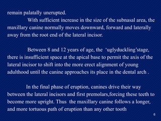 impacted canine tooth: Clinical Features, Radiographic Evaluation, and ...