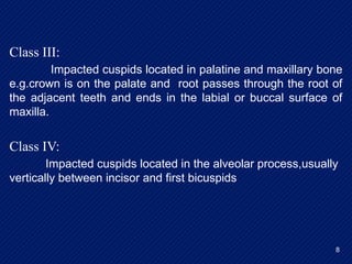 impacted canine tooth: Clinical Features, Radiographic Evaluation, and ...