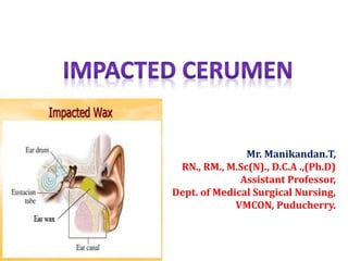 Cerumen Impaction