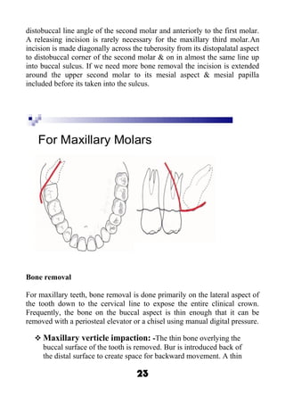 Impacted lower and upper 3rd molar lecture | PDF
