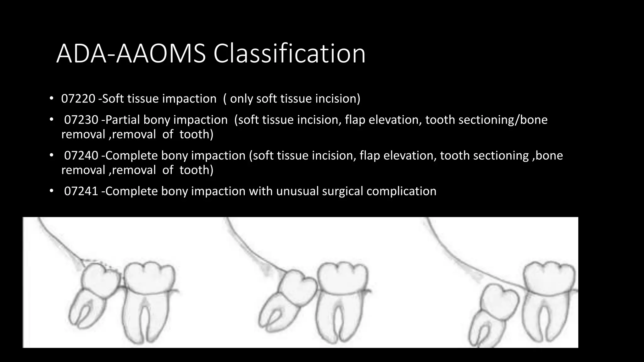 Impacted mandibular third molars | PPTX