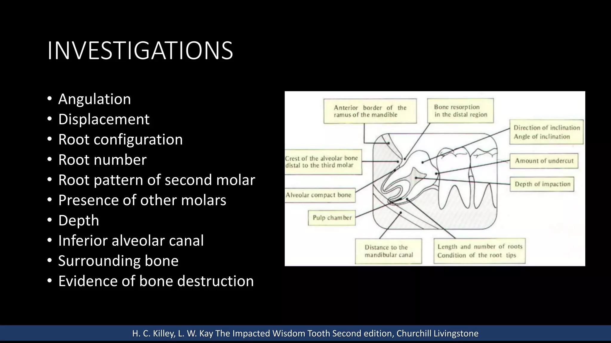 Impacted mandibular third molars | PPTX