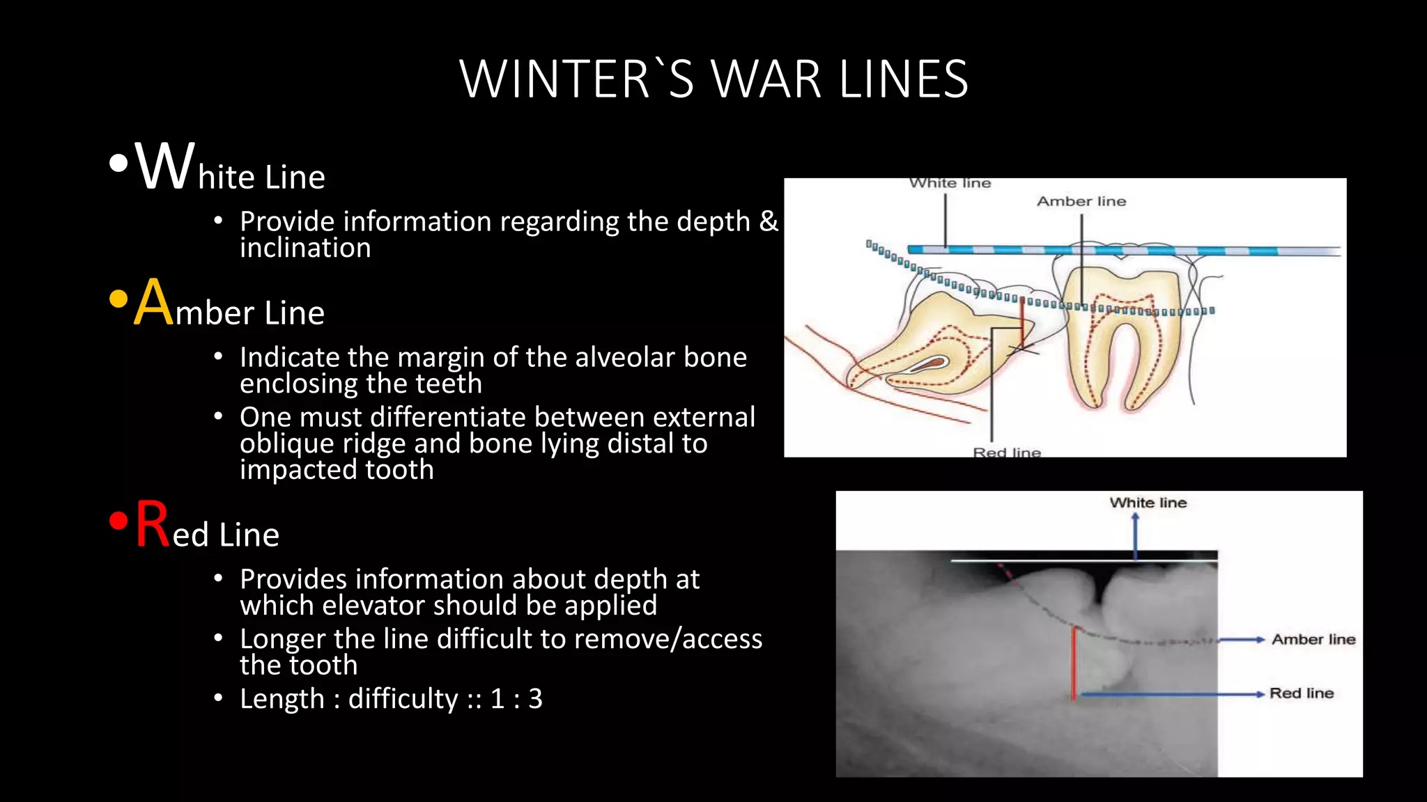 Impacted mandibular third molars | PPTX