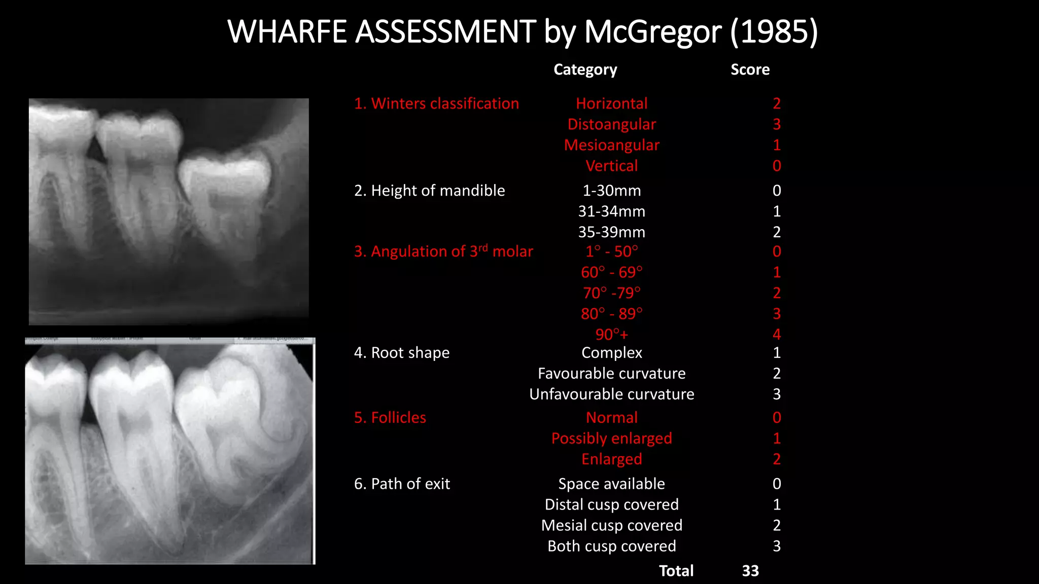 Impacted mandibular third molars | PPTX