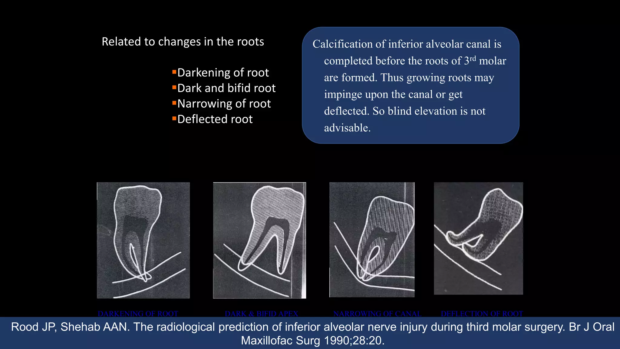 Impacted mandibular third molars | PPTX