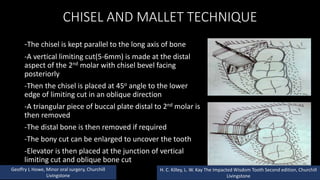 Impacted mandibular third molars | PPTX