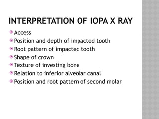 impacted mandibular third molar (1).pptx