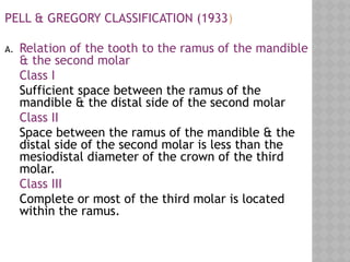 impacted mandibular third molar (1).pptx