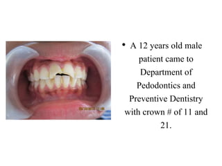 Impacted supernumerary | PPTX