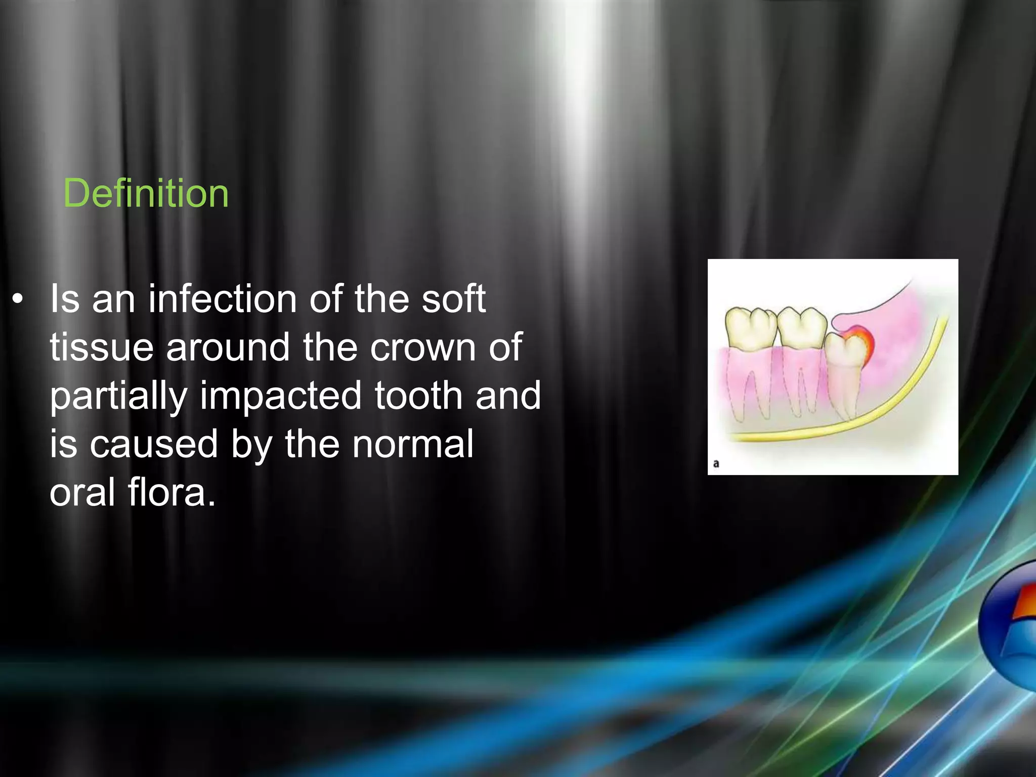 Impacted teeth | PDF