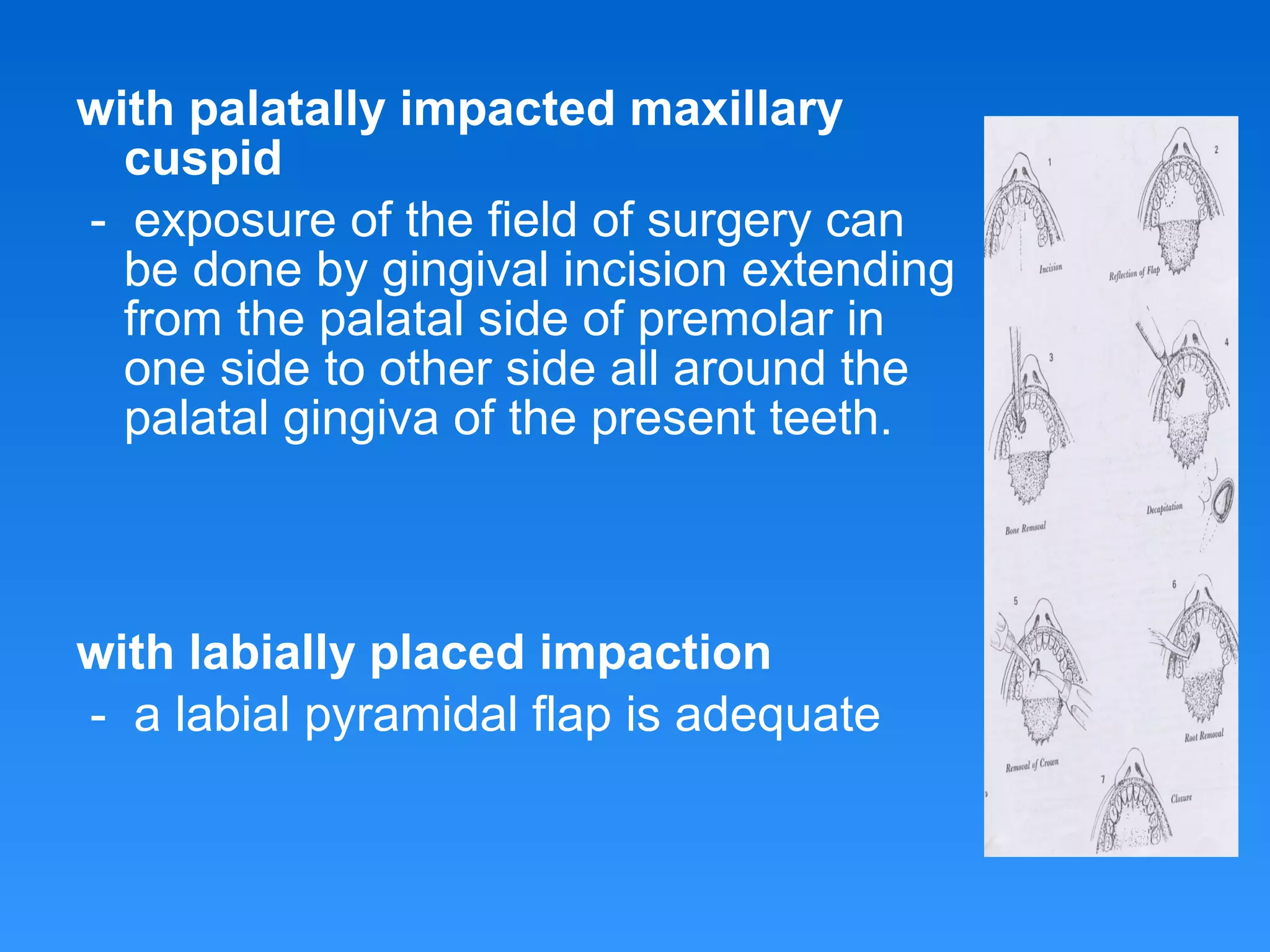 Impacted teeth | PPT