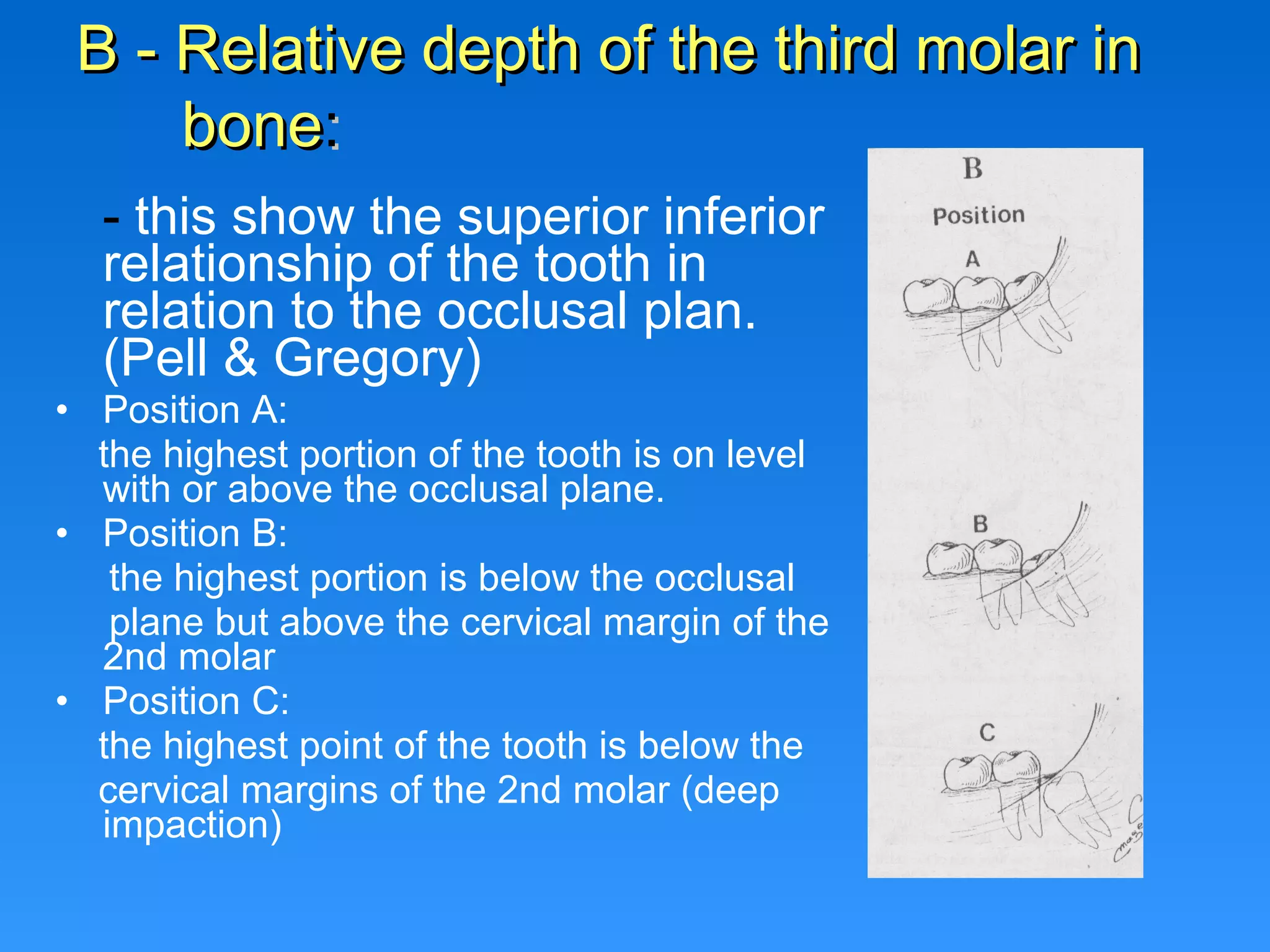 Impacted teeth | PPT