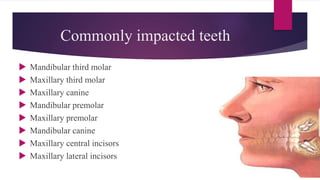 Impacted teeth / Dr.sarah alkhateeb | PPTX