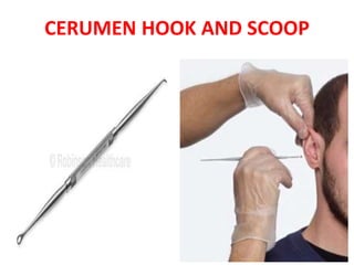 Impacted wax | PDF