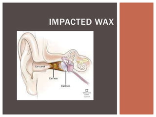 Impacted wax and nursing care | PPT