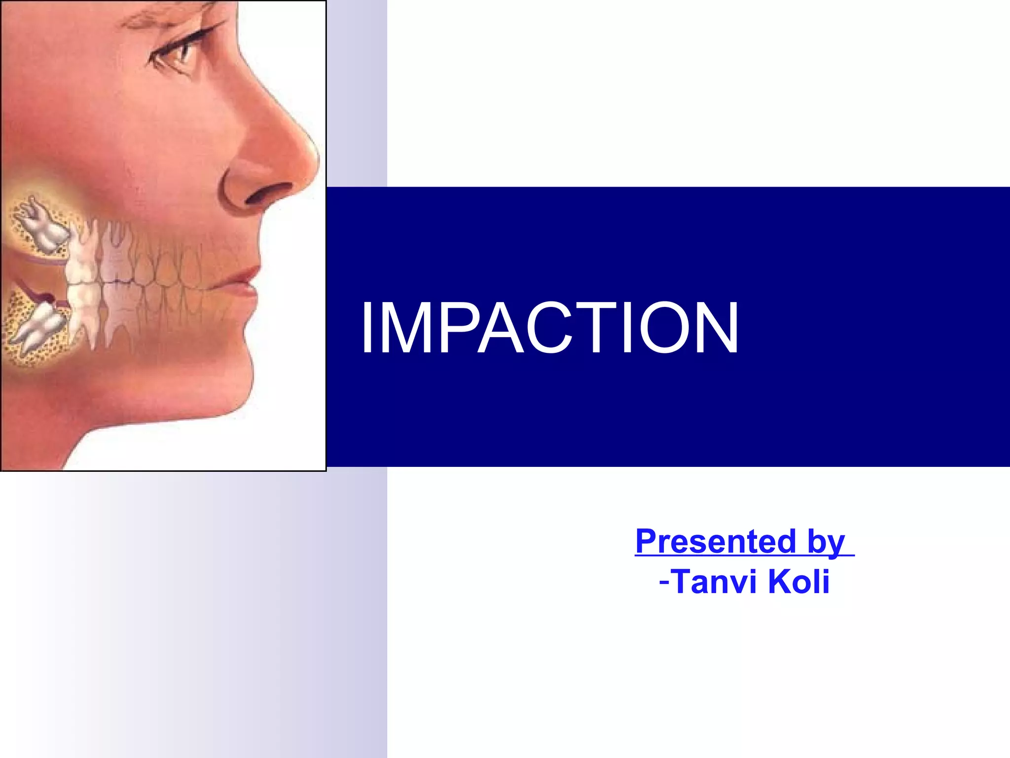 Impaction | PPT