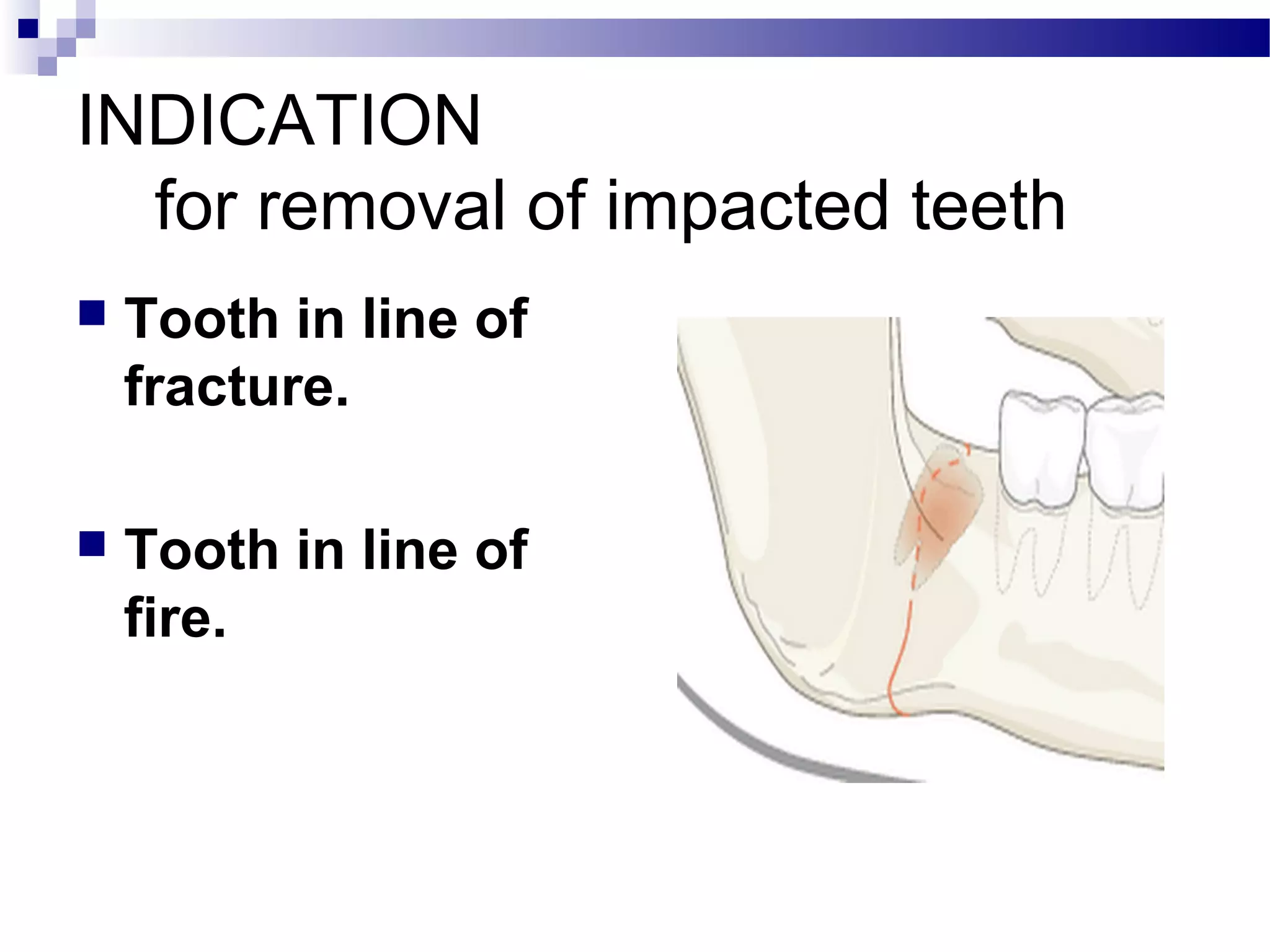 Impaction | PPT