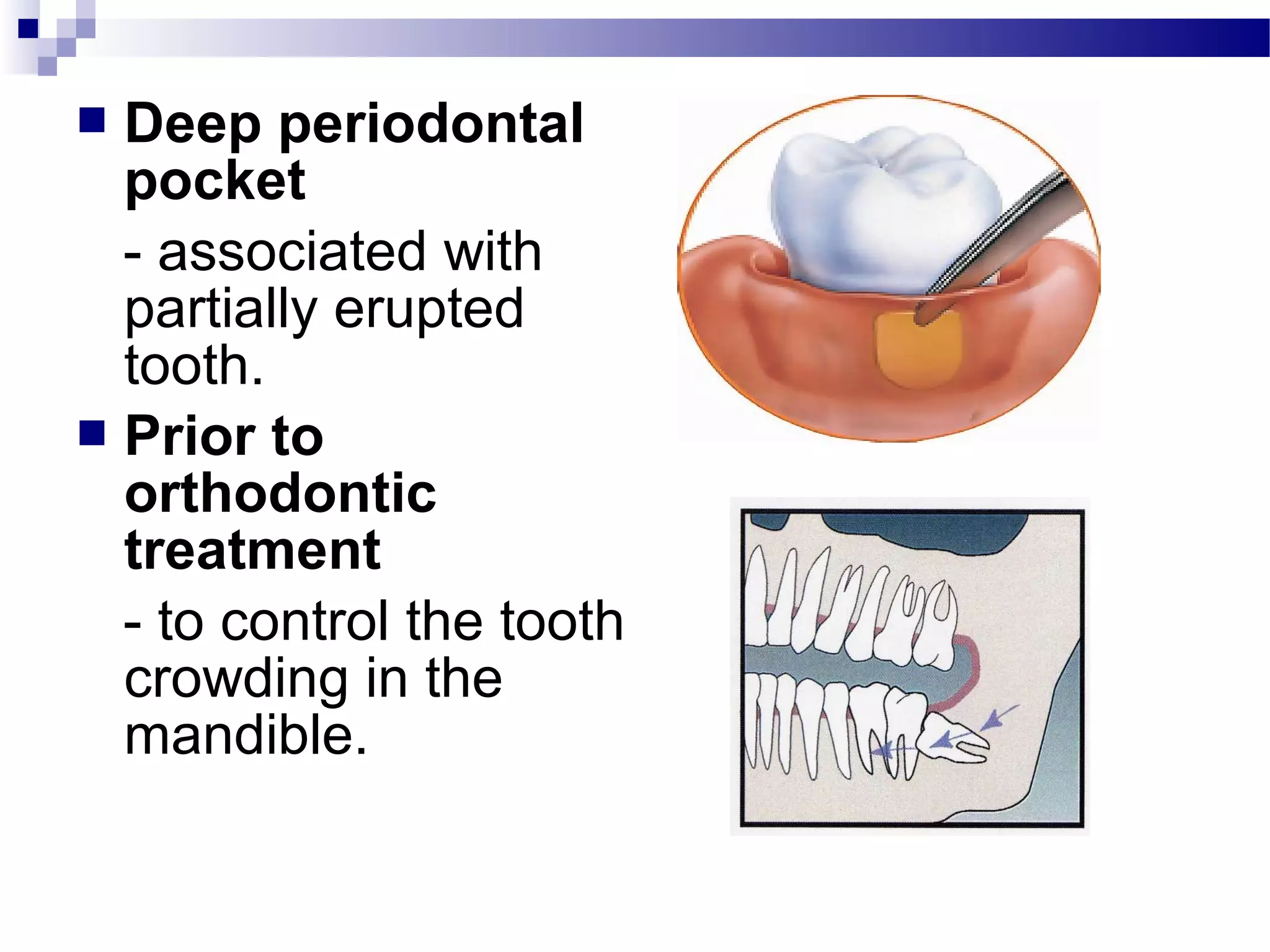 Impaction | PPT