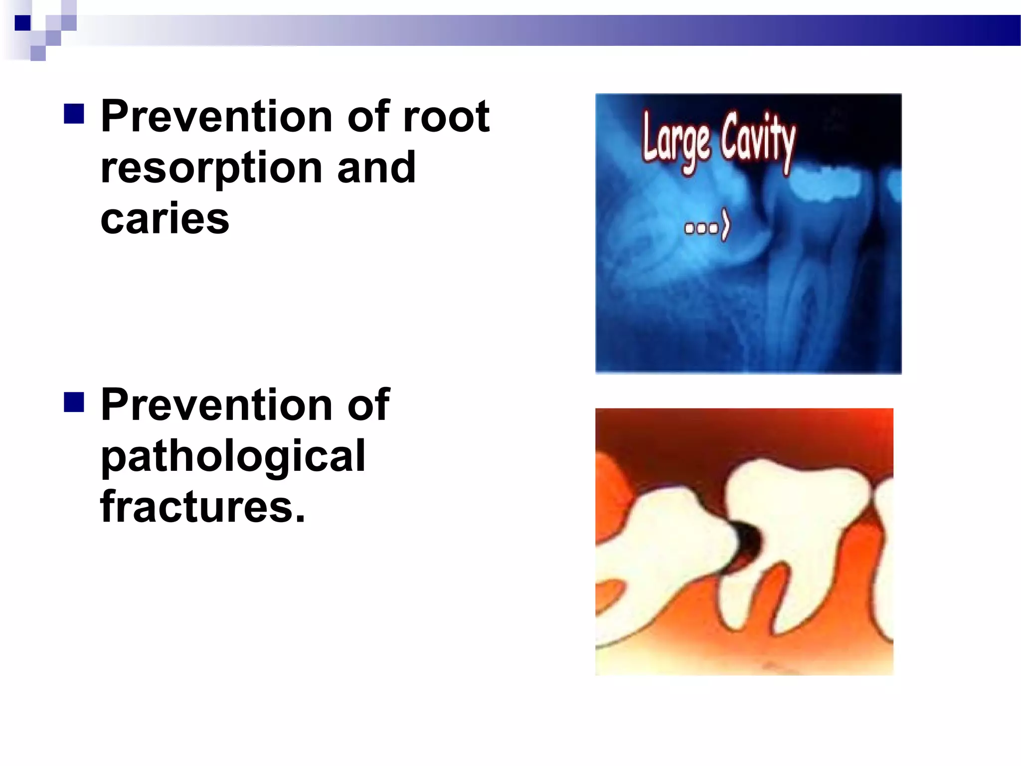 Impaction | PPT
