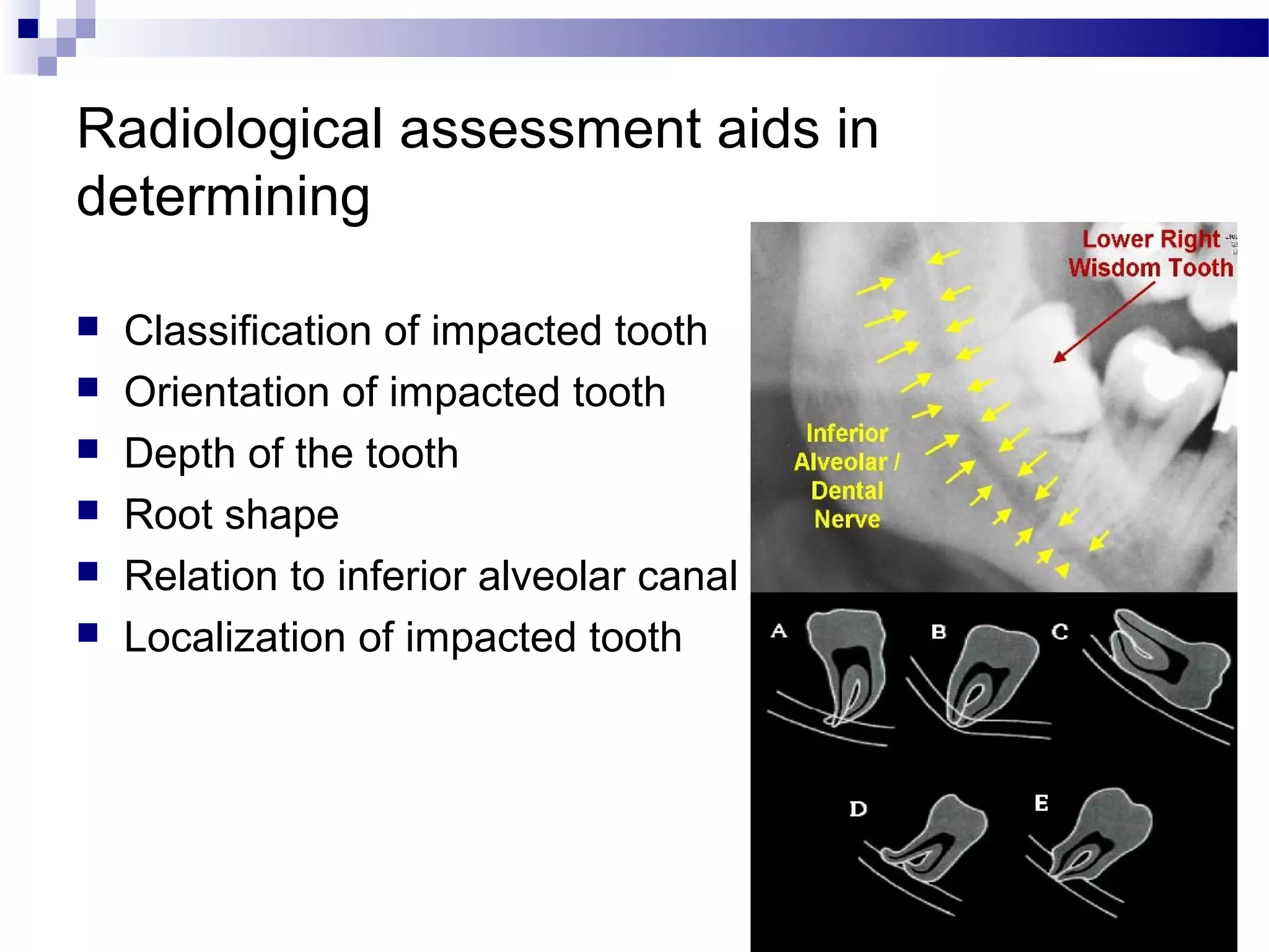 Impaction | PPT