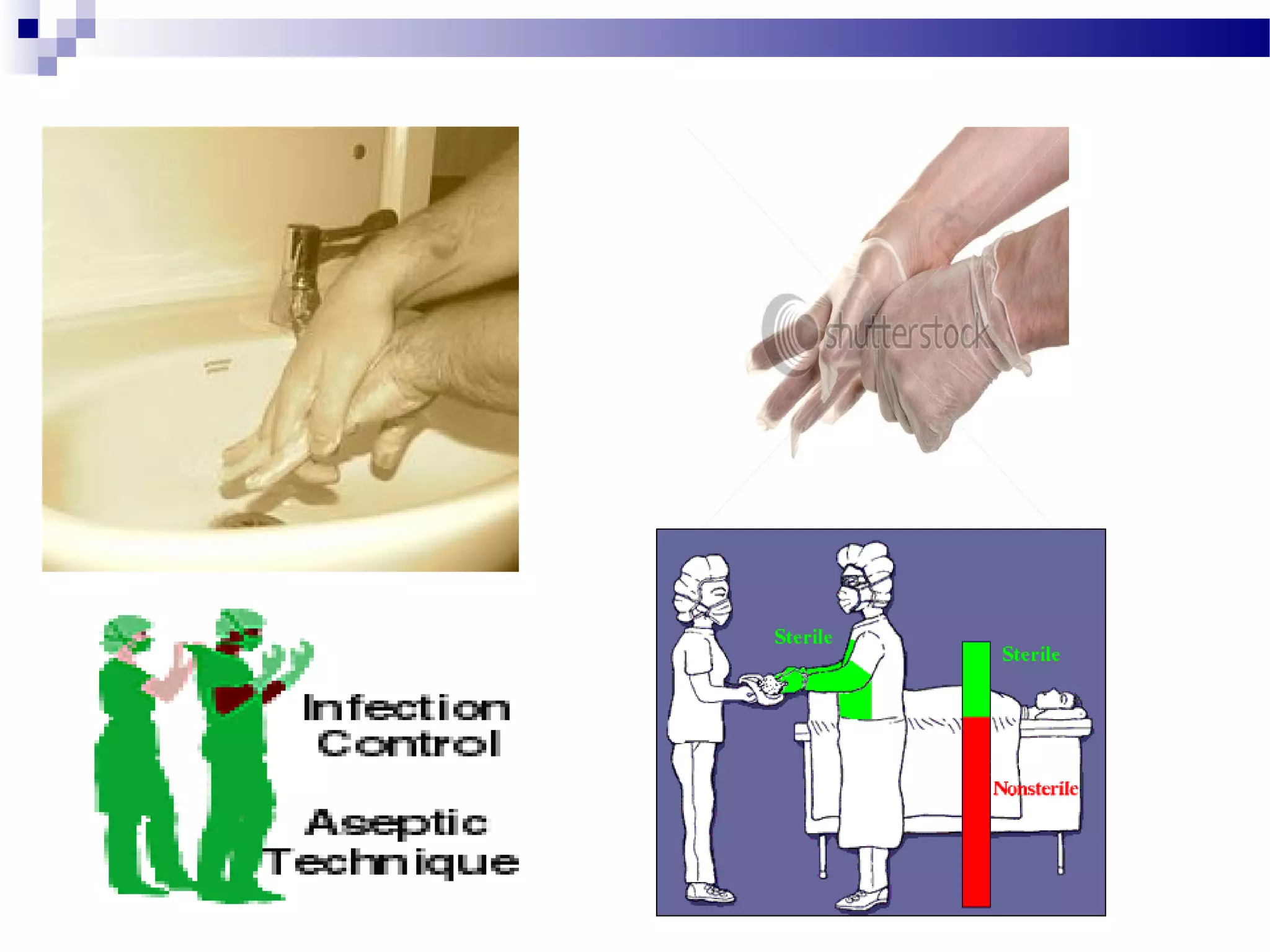 Impaction | PPT