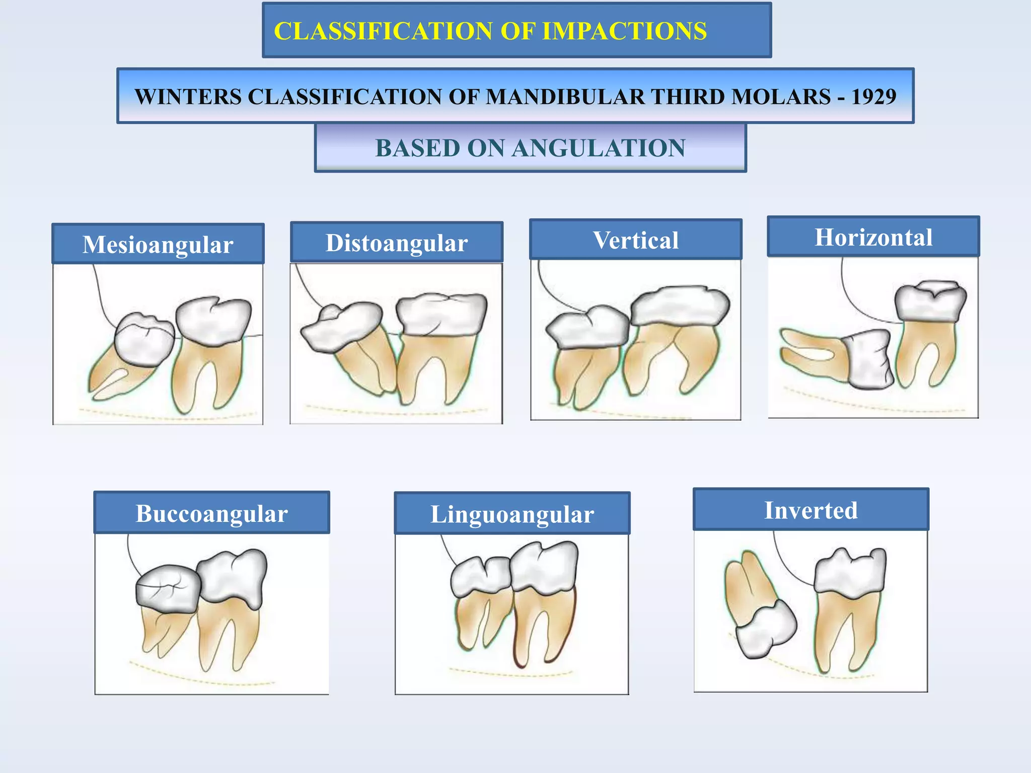 Impaction | PPTX