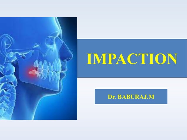 Impaction | PPTX | Dental Health | Diseases and Conditions