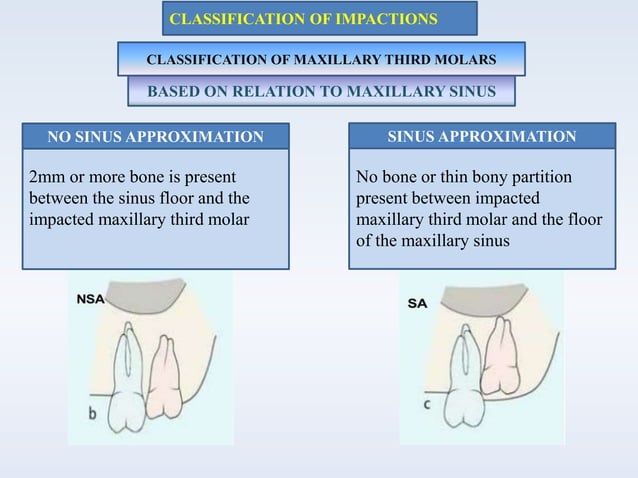 Impaction | PPTX | Dental Health | Diseases and Conditions