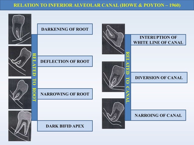 Impaction | PPTX | Dental Health | Diseases and Conditions