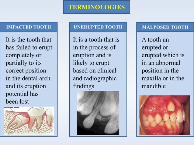 Impaction | PPTX | Dental Health | Diseases and Conditions