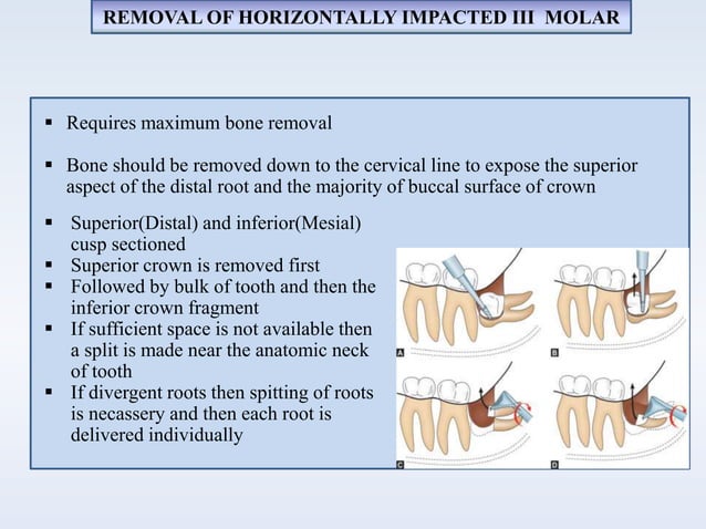 Impaction | PPTX | Dental Health | Diseases and Conditions