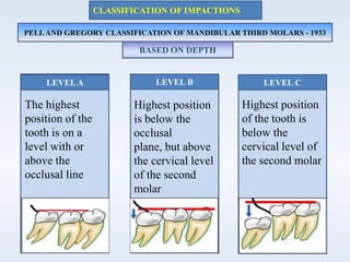 Impaction | PPT