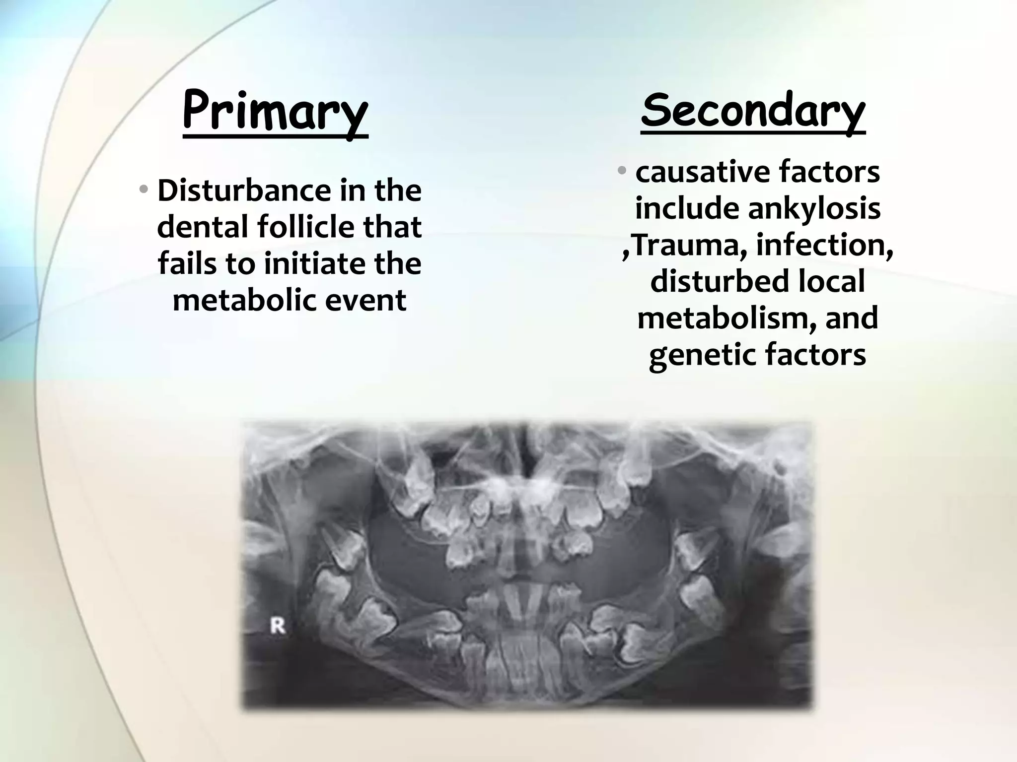IMPACTION IN ORAL SURGERY | PPTX